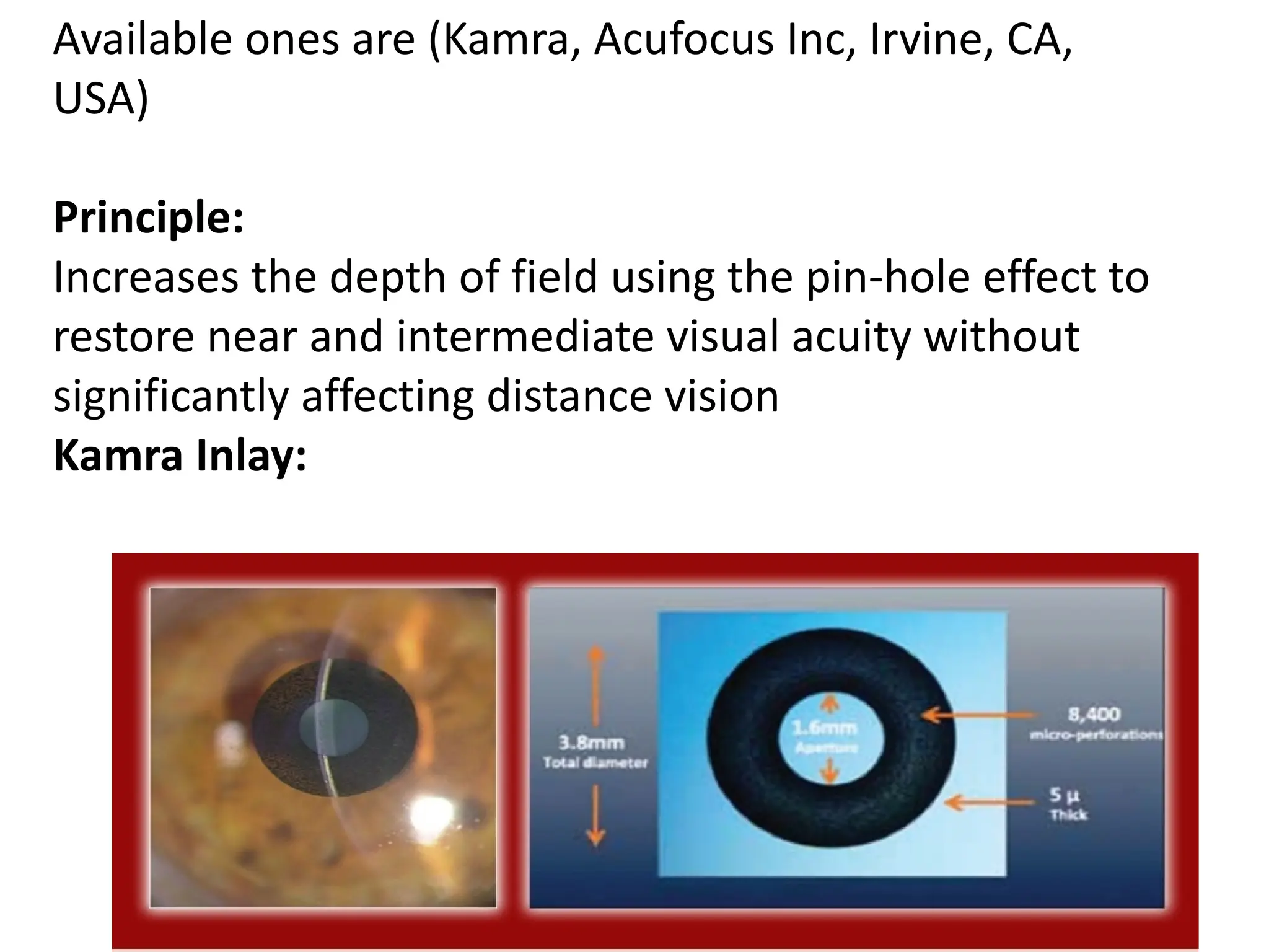 PRESBYOPIA the presentation ophthalmology | PDF