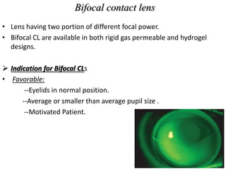 Presbyopic contact lens description | PDF