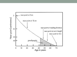 Presbyopia | PPT