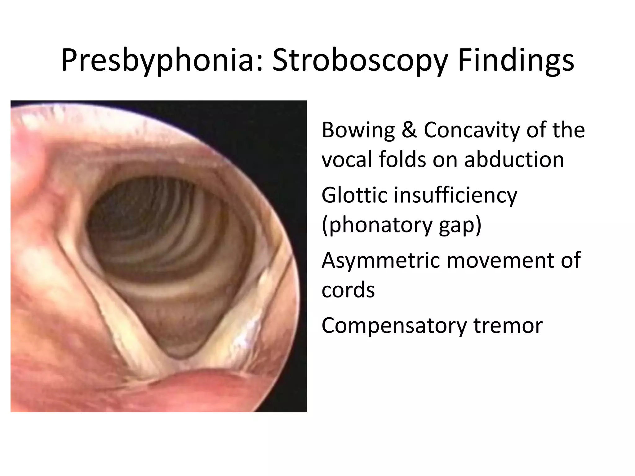 Presbyphonia aging & voice | PPTX