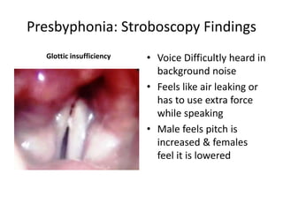 Presbyphonia aging & voice | PPTX