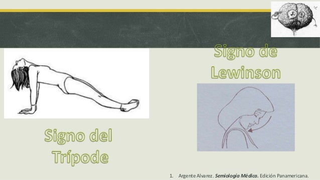 Abordaje de Meningitis bacteriana