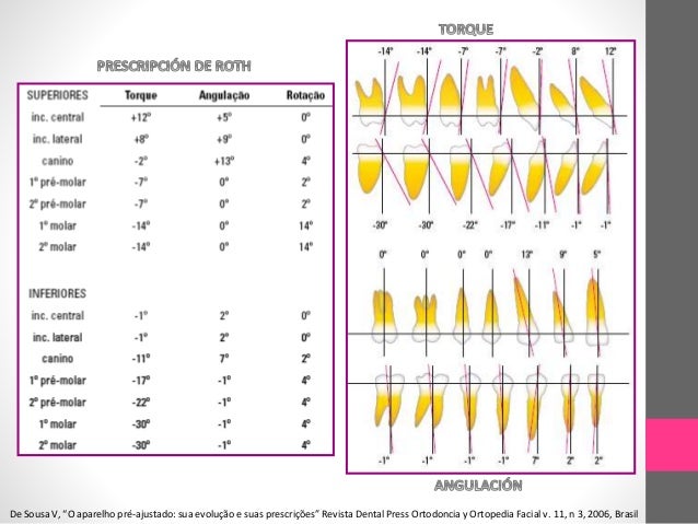 Prescripciones de Brackets