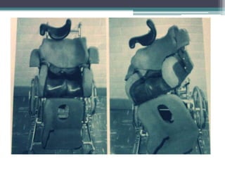 Prescription of wheelchair | PPTX