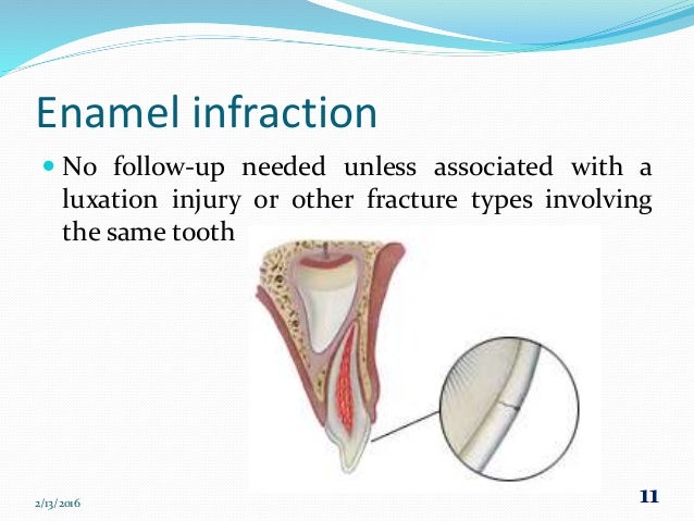 Present a schedule for follow up of patients who have sustained denta…