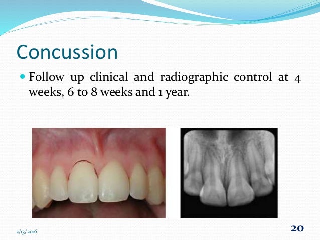 Present a schedule for follow up of patients who have sustained denta…