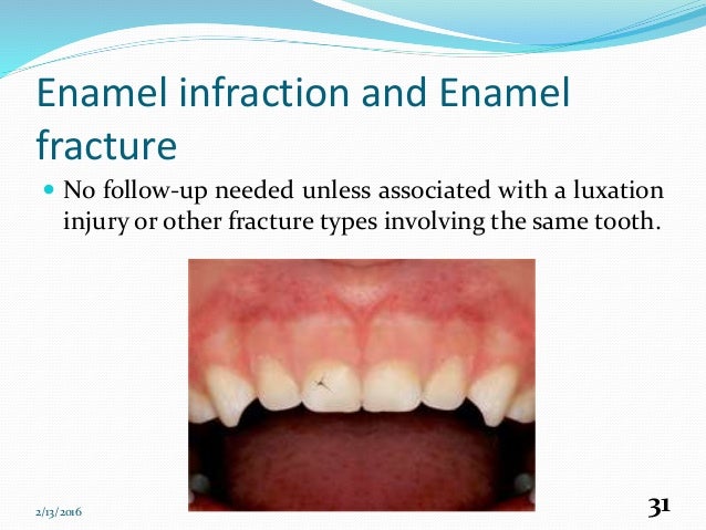 Present a schedule for follow up of patients who have sustained denta…