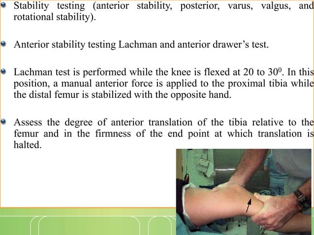 ACL rehabilitation | PPTX
