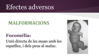 Talidomida: Malformacions congènites | PPT