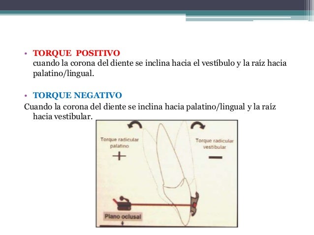 Torque Positivo Y Negativo - abstractor