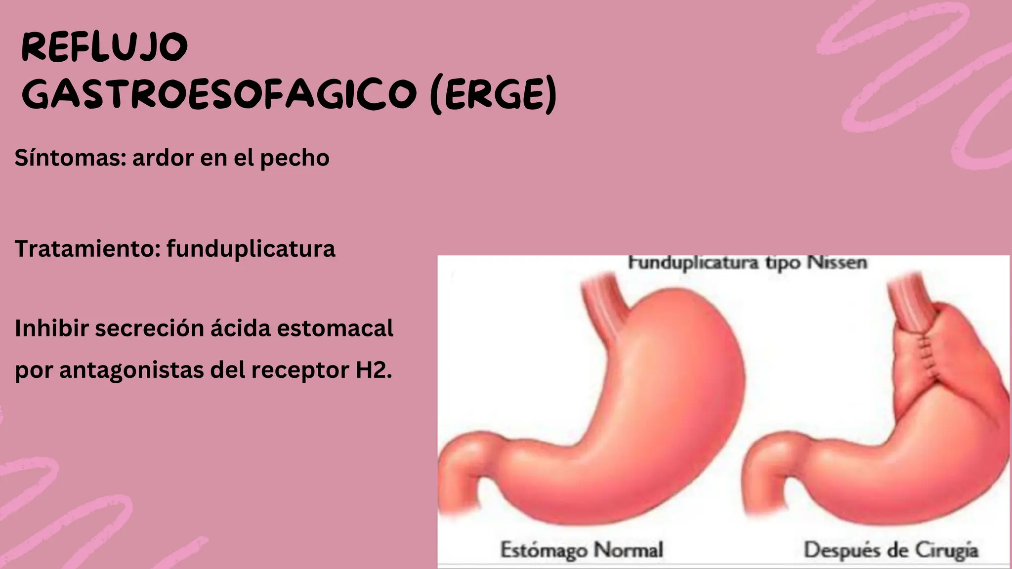 Esfinter Esofagico Inferior Anatomia Humana | PDF