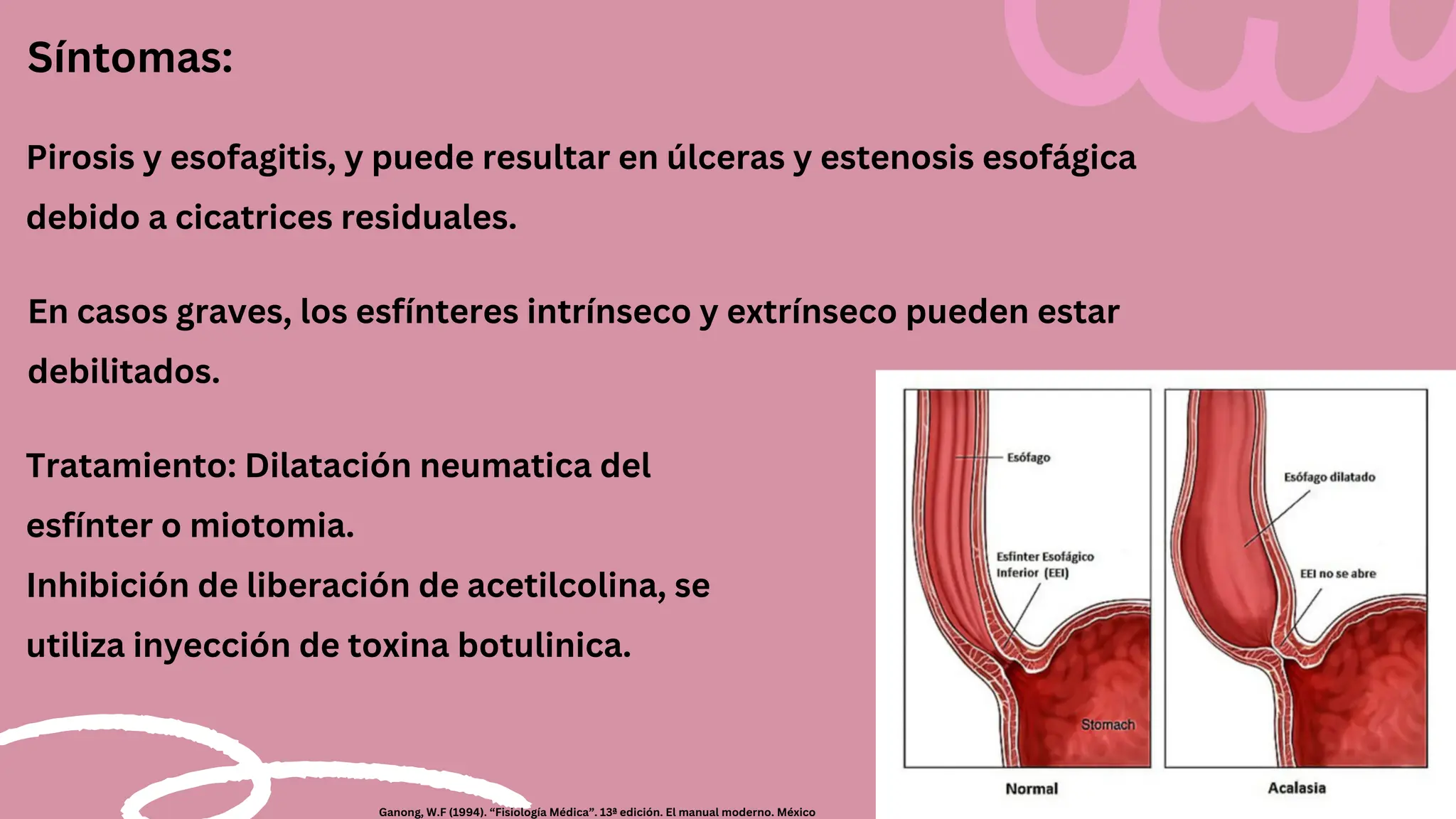 Esfinter Esofagico Inferior Anatomia Humana | PDF