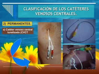 cuidados del cateter venoso central | PPT