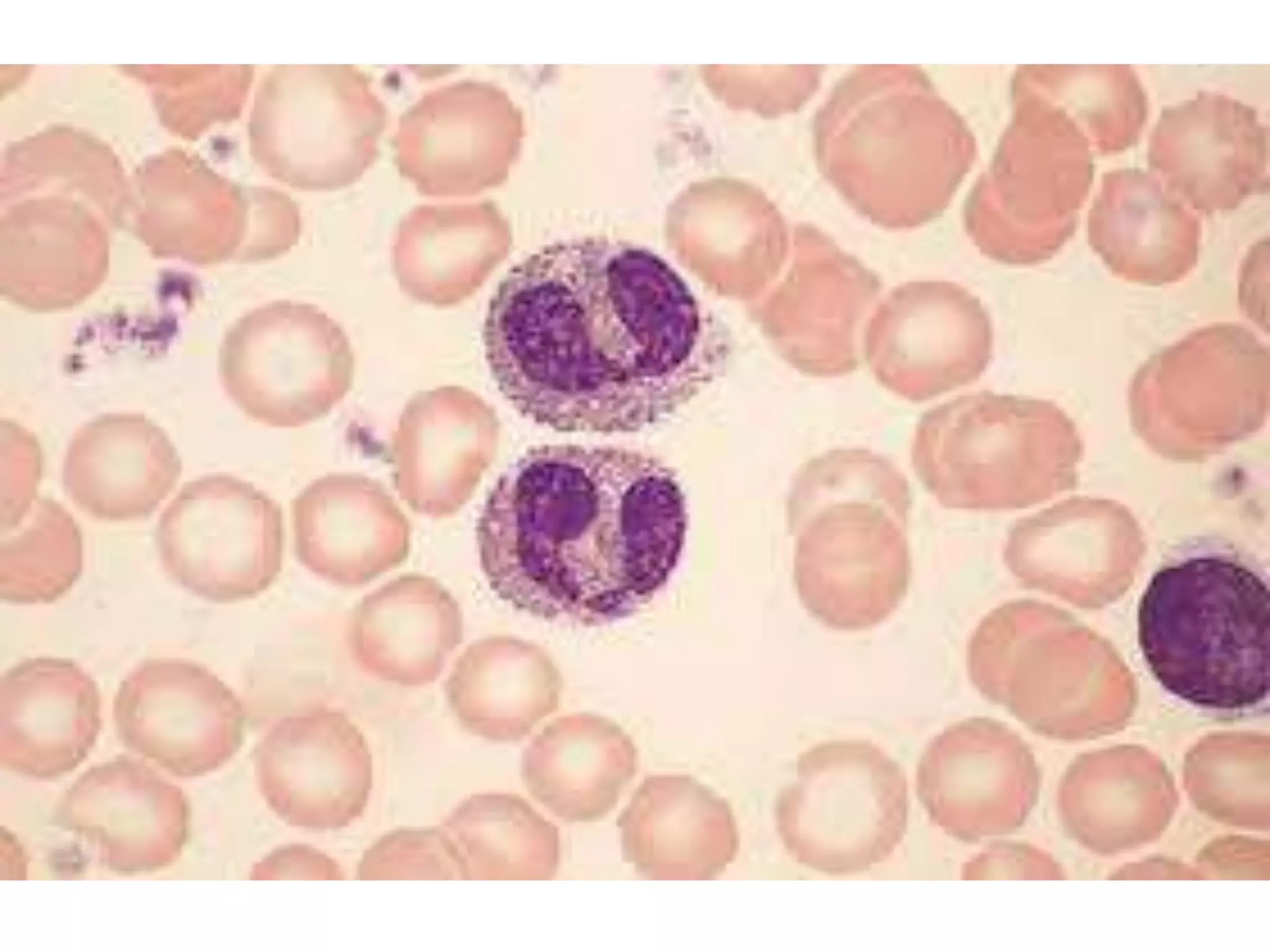 Presentación granulocitos