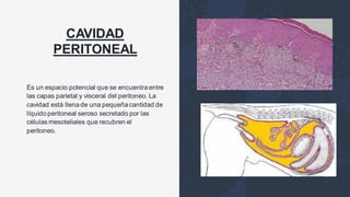 Presentación - Grupo 3 - Peritoneo, intestino, estómago (1).pdf