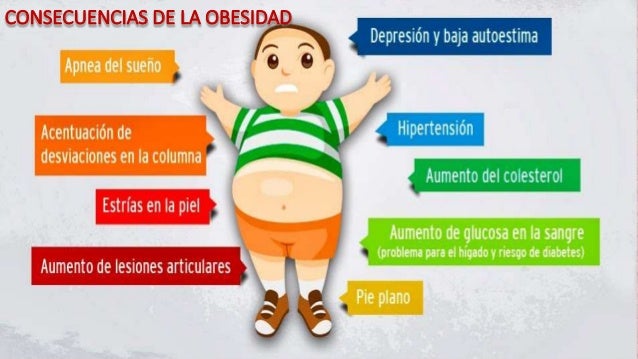 Sobrepeso Y Obesidad Infantil
