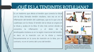 Tendinitis rotuliana | PPTX