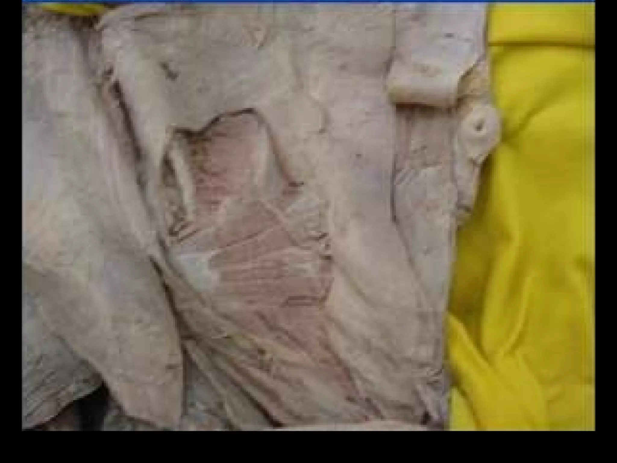 abdomen visceral | PPT