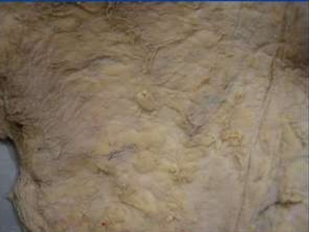 abdomen visceral | PPT