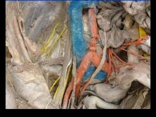 abdomen visceral | PPT