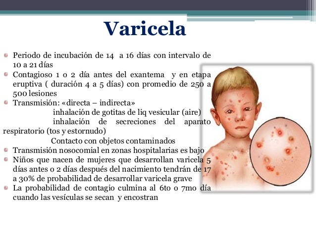 Varicela