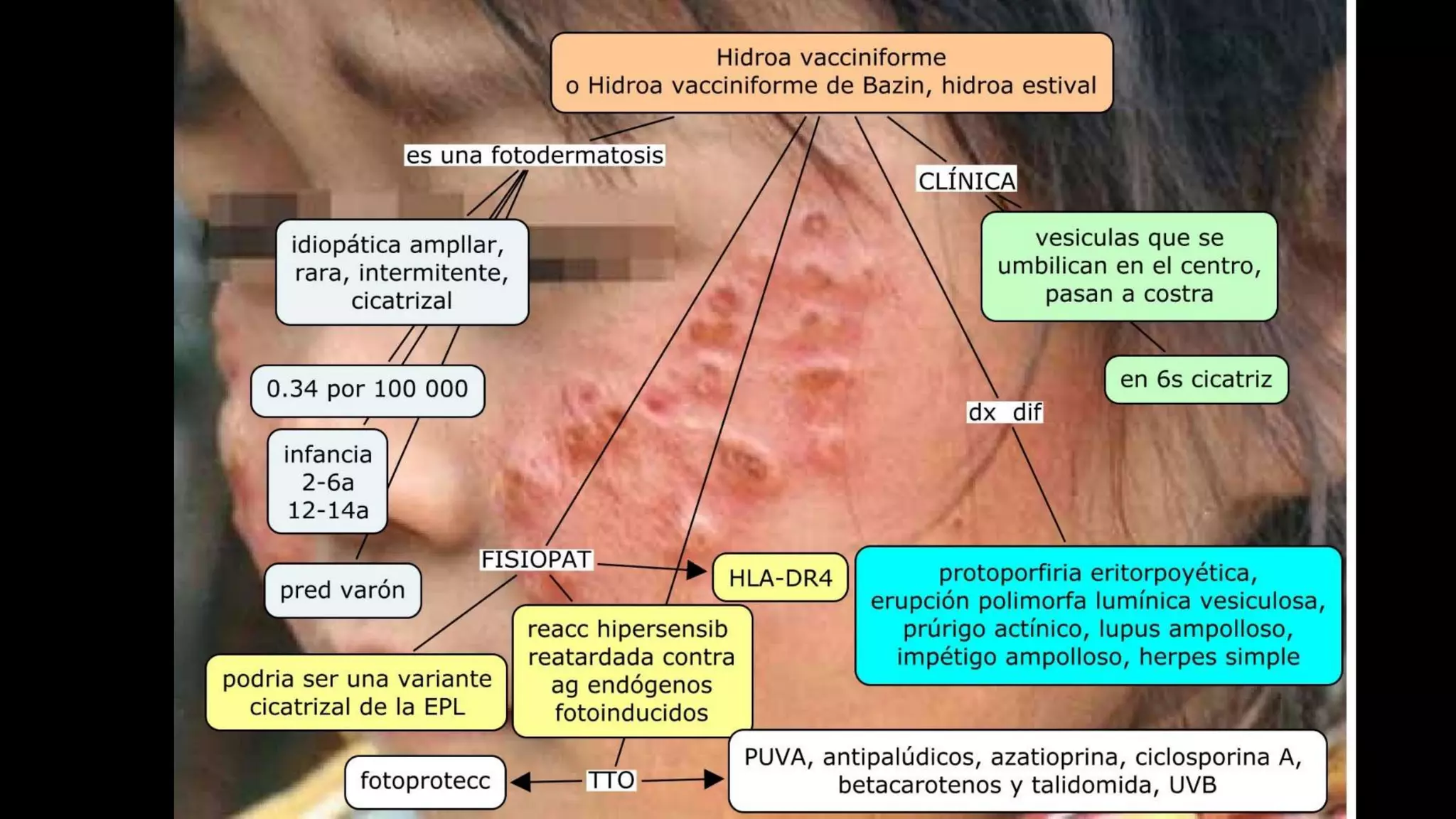 FOTODERMATOSIS | PPTX