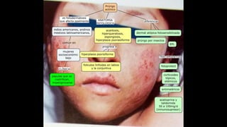 FOTODERMATOSIS | PPTX