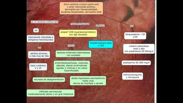 FOTODERMATOSIS | PPTX