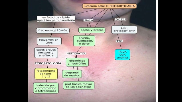 FOTODERMATOSIS | PPTX
