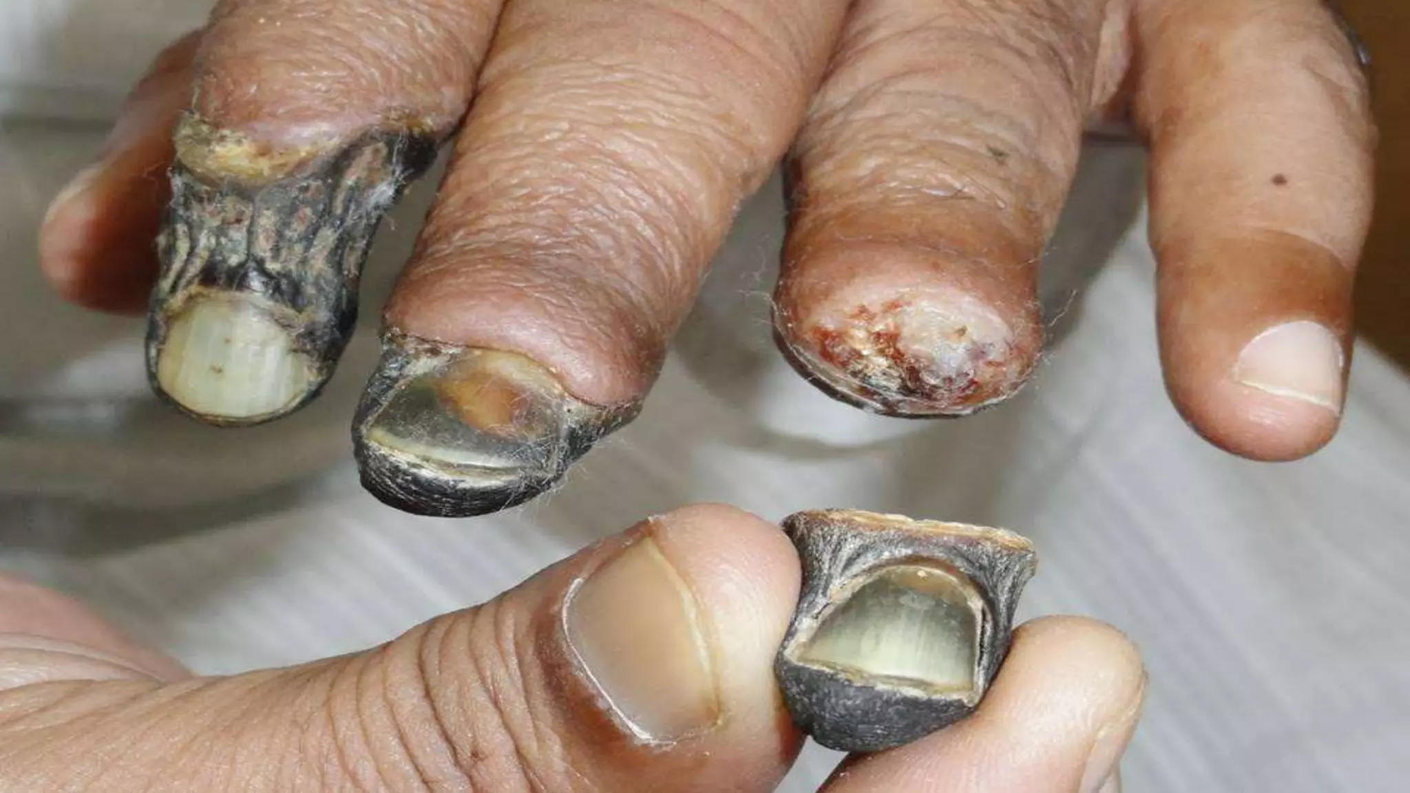 la droga krokodil | PPT