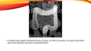 colon por enema | PPTX