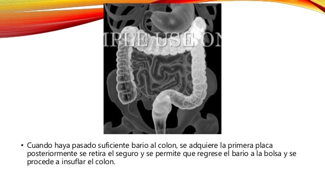 colon por enema