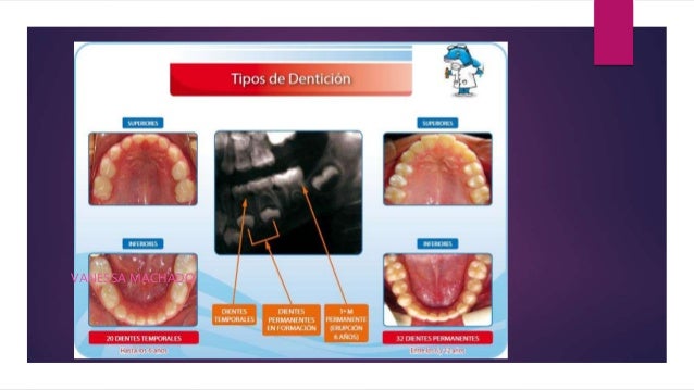 tipos de denticion