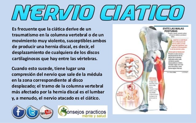 tratamiento para el nervio ciatico que es el nervio ciatico