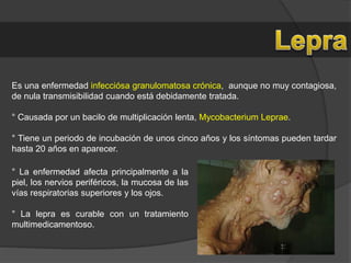 Lepra y Leptospirosis | PPTX