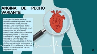 ANGINA DE PECHO.pptx