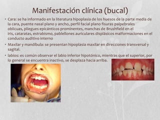 SINDROME DE DOWN | PPTX