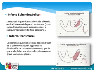 Infarto al Miocardio fisiopatologia | PPTX