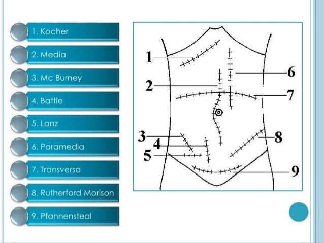 Presentación1cirugia