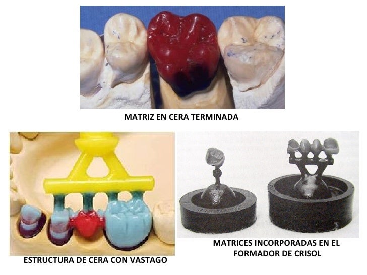 algunos materiales usados en colado