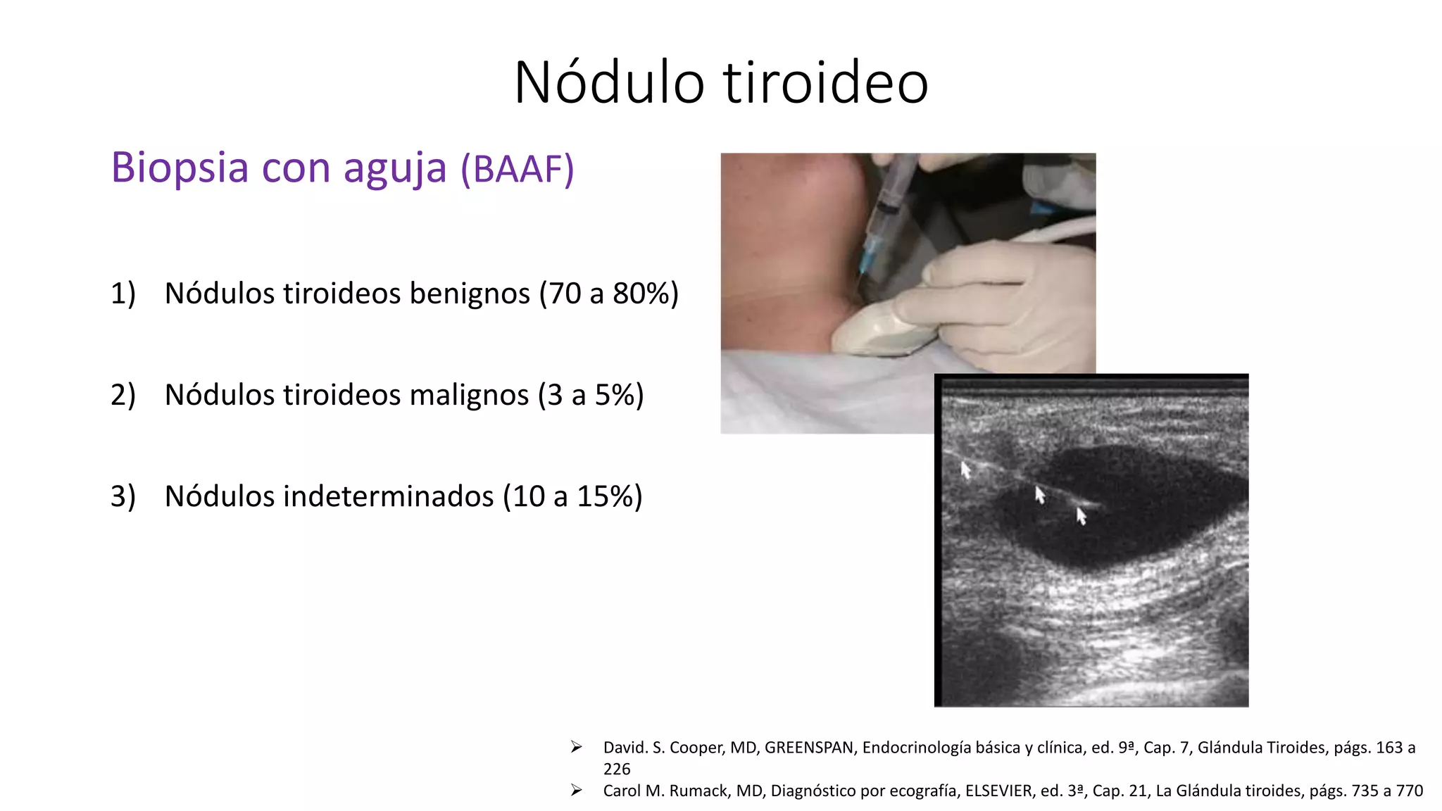 Nódulo tiroideo y cáncer de tiroides | PPTX | Thyroid Disorders ...