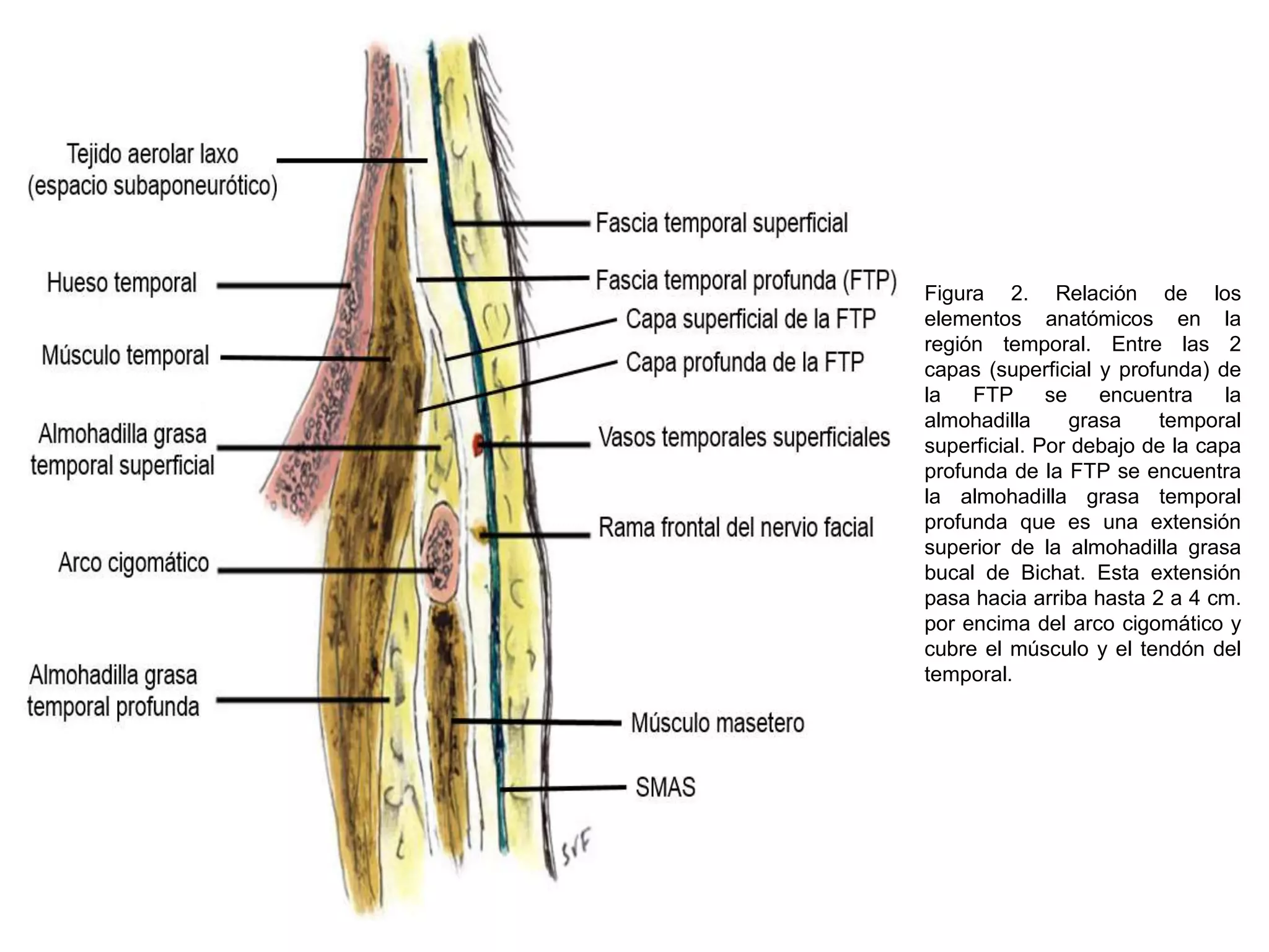 ANATOMIA QUIRURGICA DE LA REGION TEMPORAL | PPTX