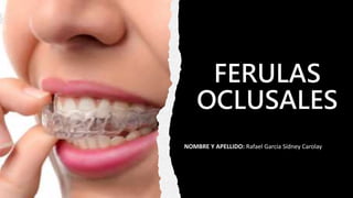 tipos de ferula | PPTX