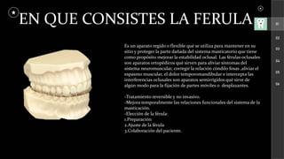 tipos de ferula | PPTX
