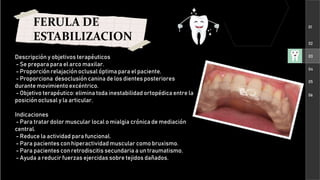tipos de ferula | PPTX