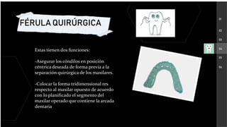 tipos de ferula | PPTX