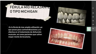 tipos de ferula | PPTX