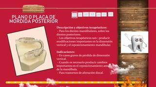 tipos de ferula | PPTX