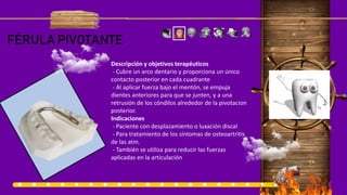tipos de ferula | PPTX