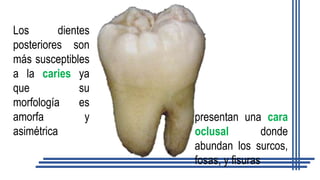 etiología de la caries dental | PPTX